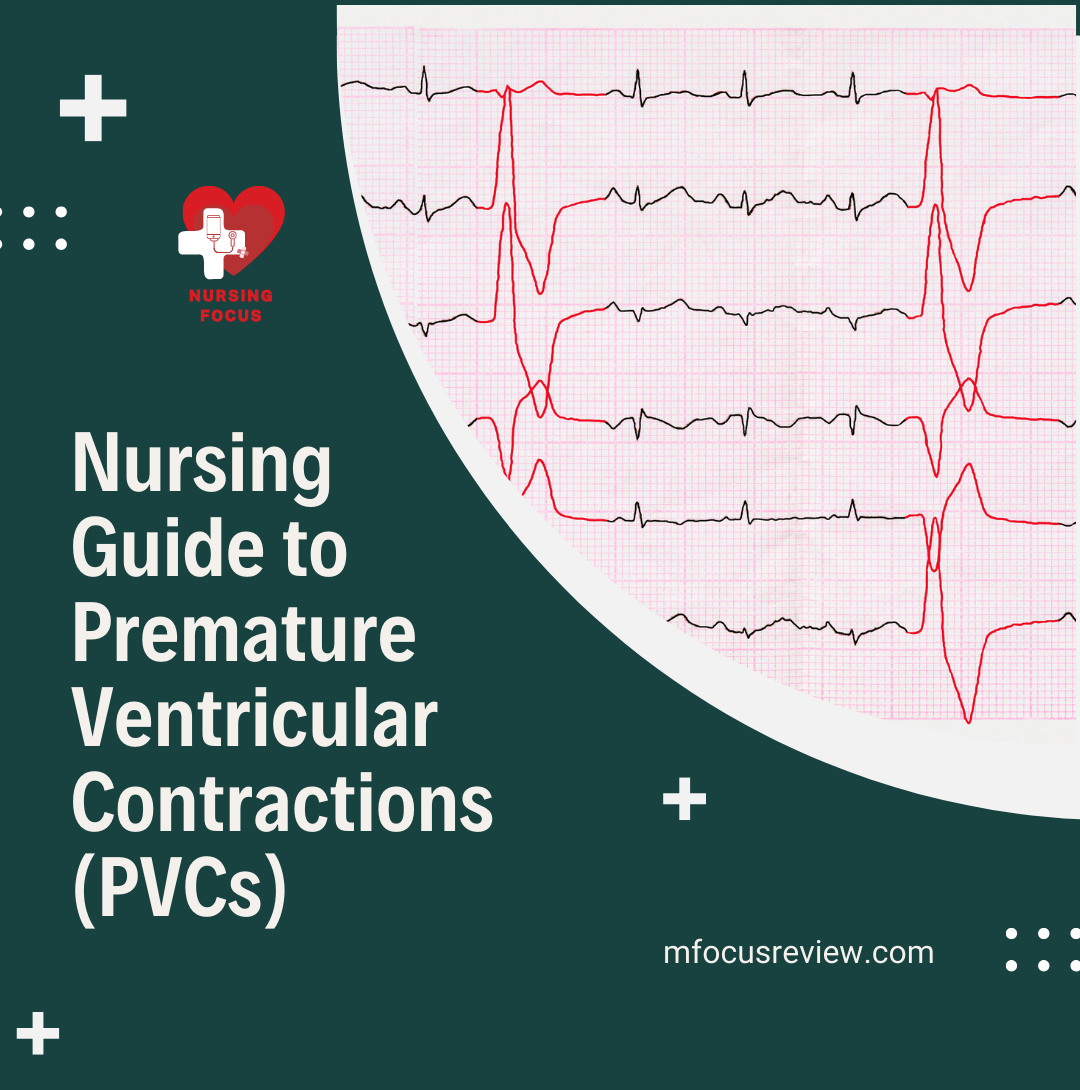 Nursing Guide to Premature Ventricular Contractions (PVCs) – Nursing Focus